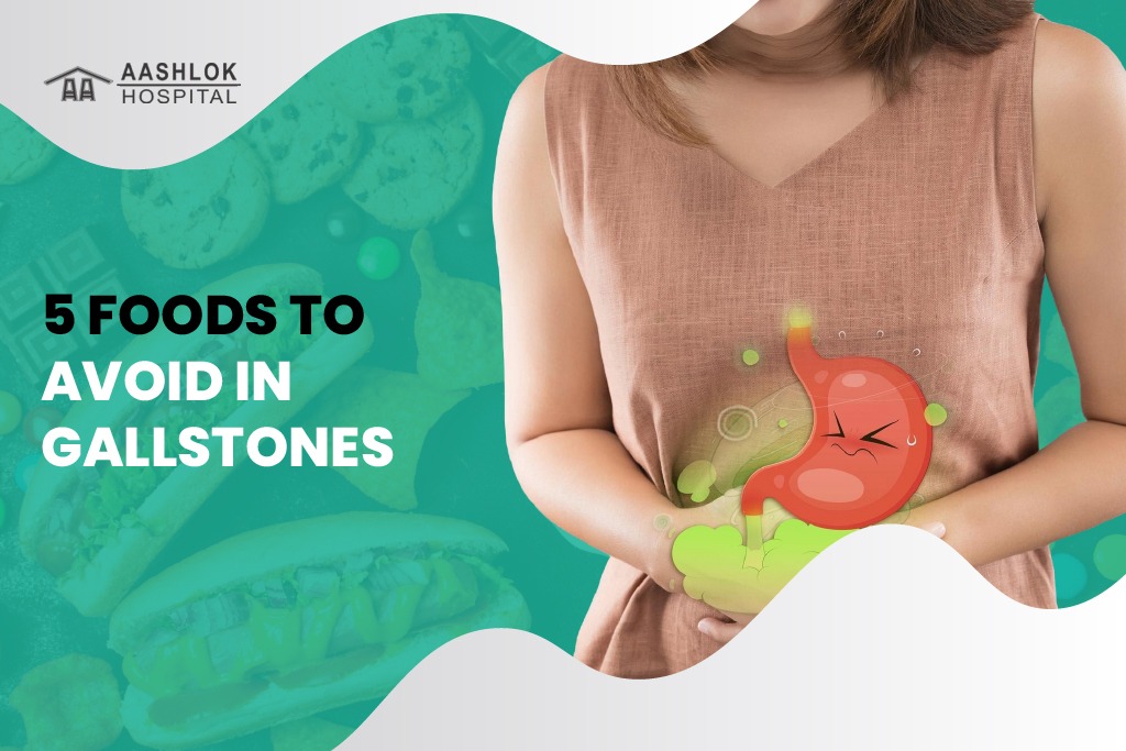 5 Foods to Avoid in Gallstones Aashlok Hospital