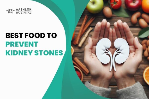 Best Foods to Prevent Kidney Stones | Aashlok Hospital